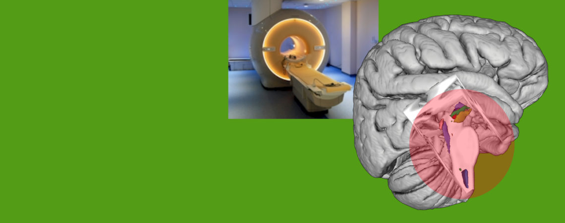 3.Bis_Sagittal_inflated_brain_profilecut_withScanner_andbackgrResize ...