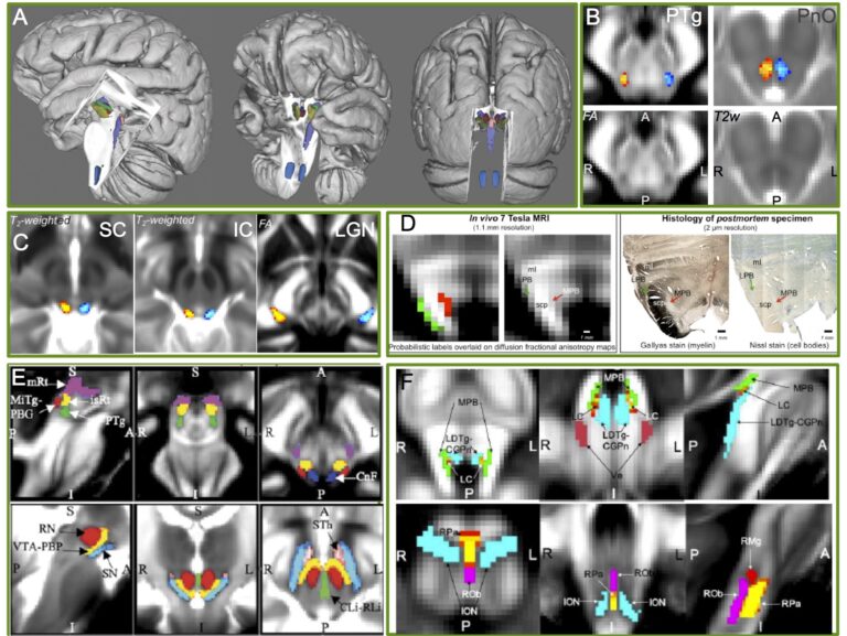 Research – The Brainstem Imaging Laboratory